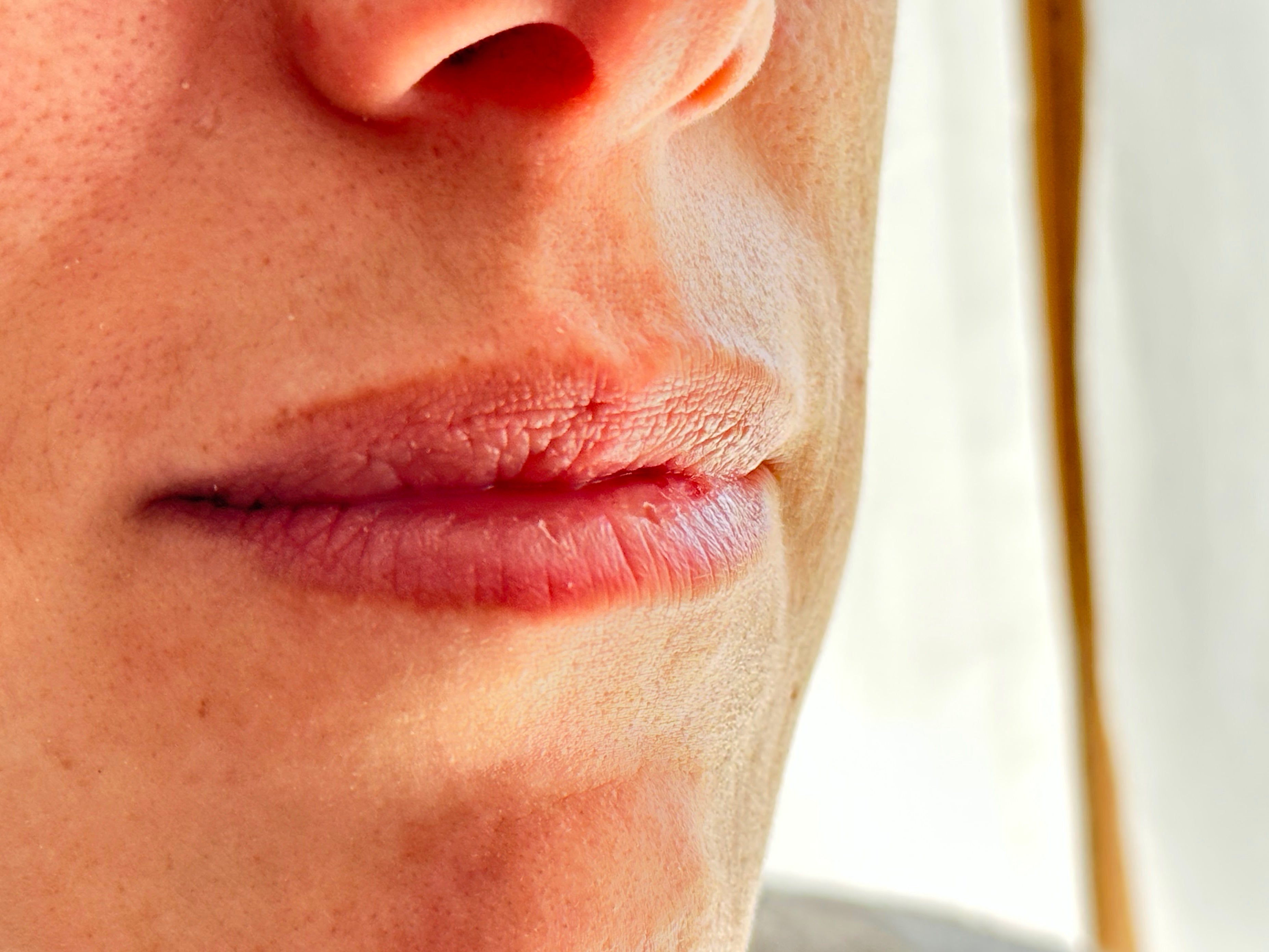 Lábios secos e gretados. Causas e como tratar? – Greenify.pt